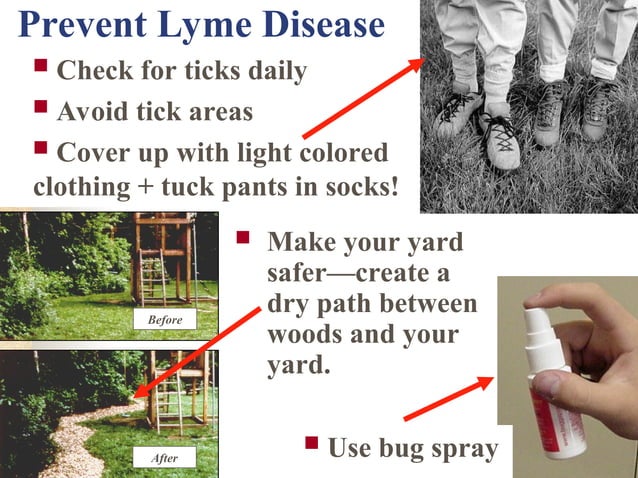 Lyme PPT for Teachersv for education only.ppt