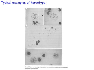 Standard Lymphocyte Culture | PPT