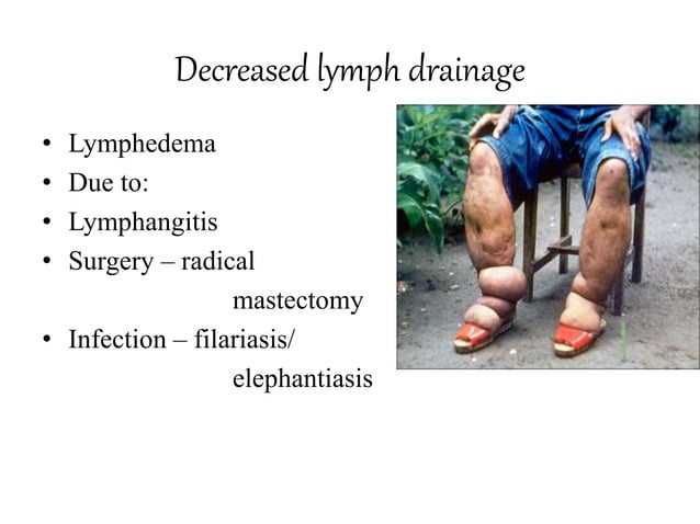 Lymph definition ,formation and factors affecting lymph flow including ...