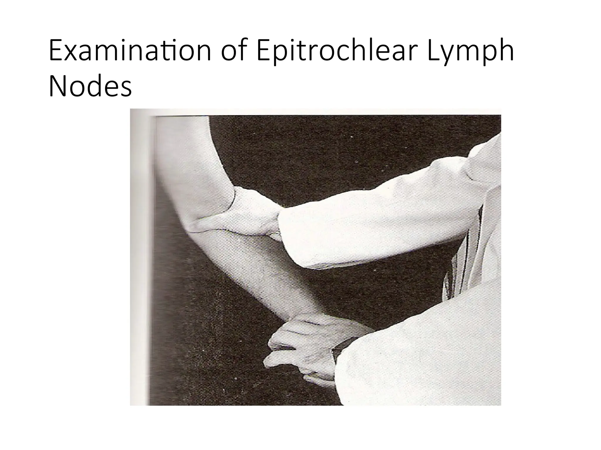 Lymphadenopathy & lymph node examination 2023 ppt | PPT