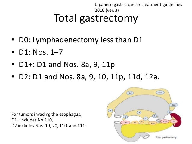 Lymphadenectomy In Carcinoma Stomach 2