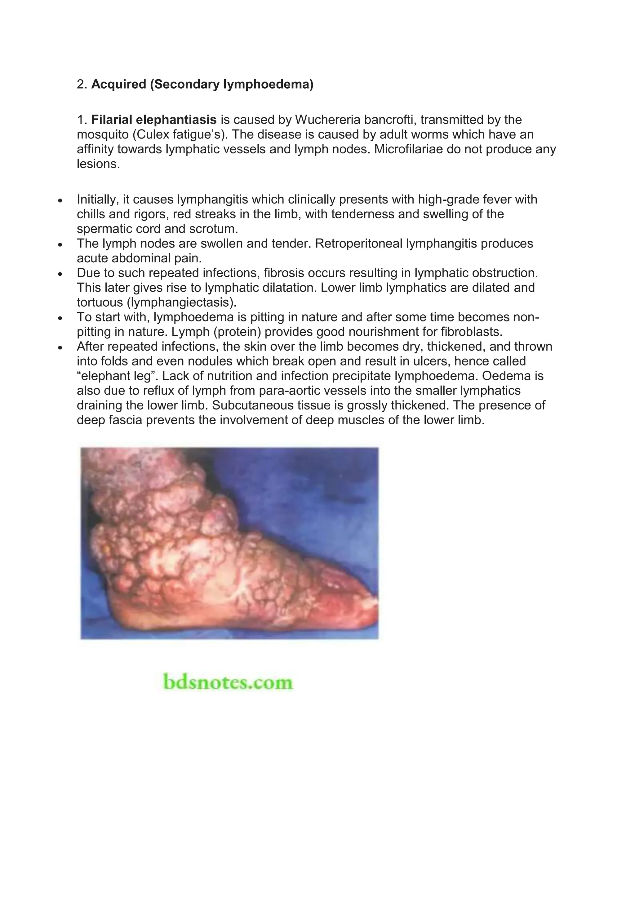 Lymphadenectomy Notes Lymphatics Lymph Vessels And Lymphoma | PDF