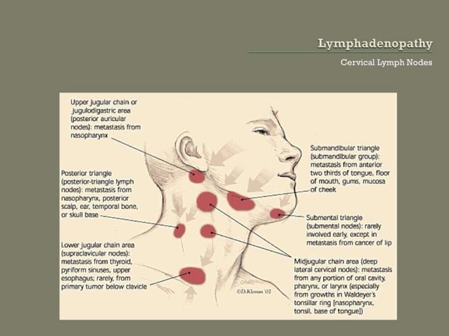 Lymphadenopathy