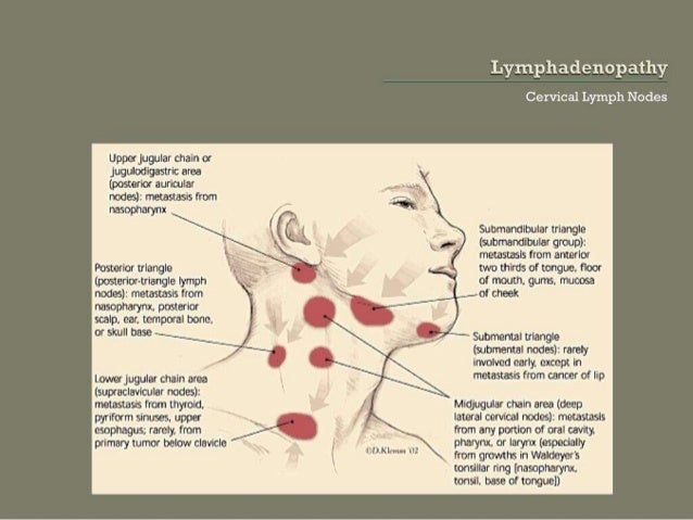 Shotty lymph nodes lymph nodes - synergyfess