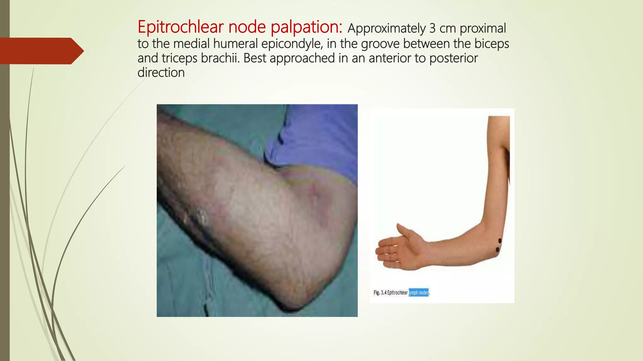Lymphadenopathy | PPTX