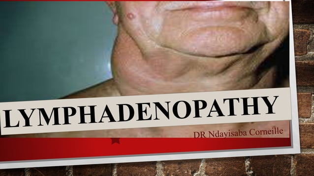 Lymphadenopathy | PPTX