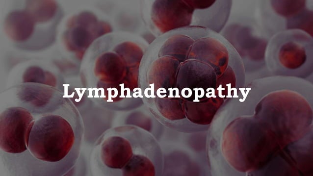 Lymphadenopathy | PPT