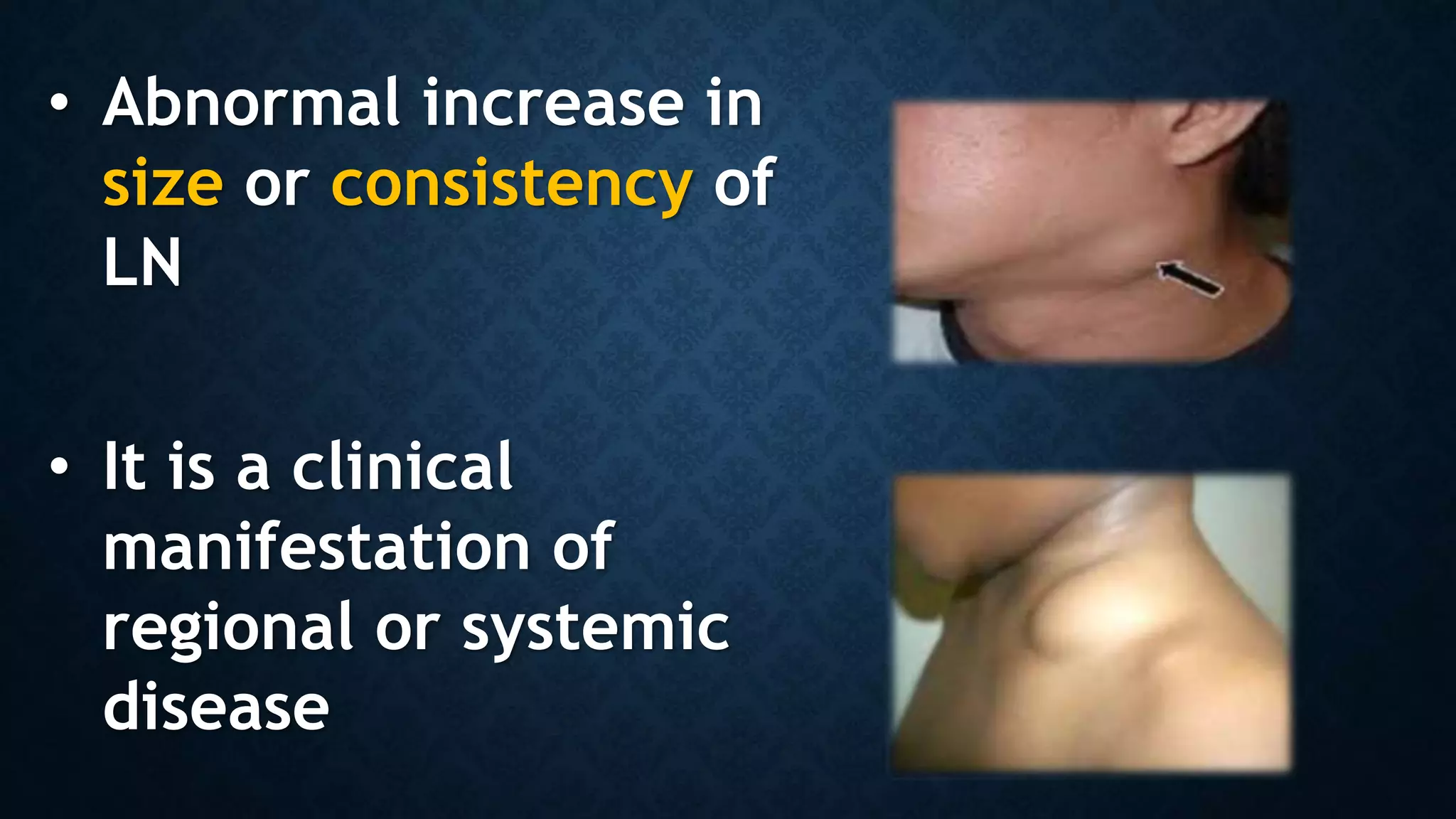 lymphadenopathy.pptx