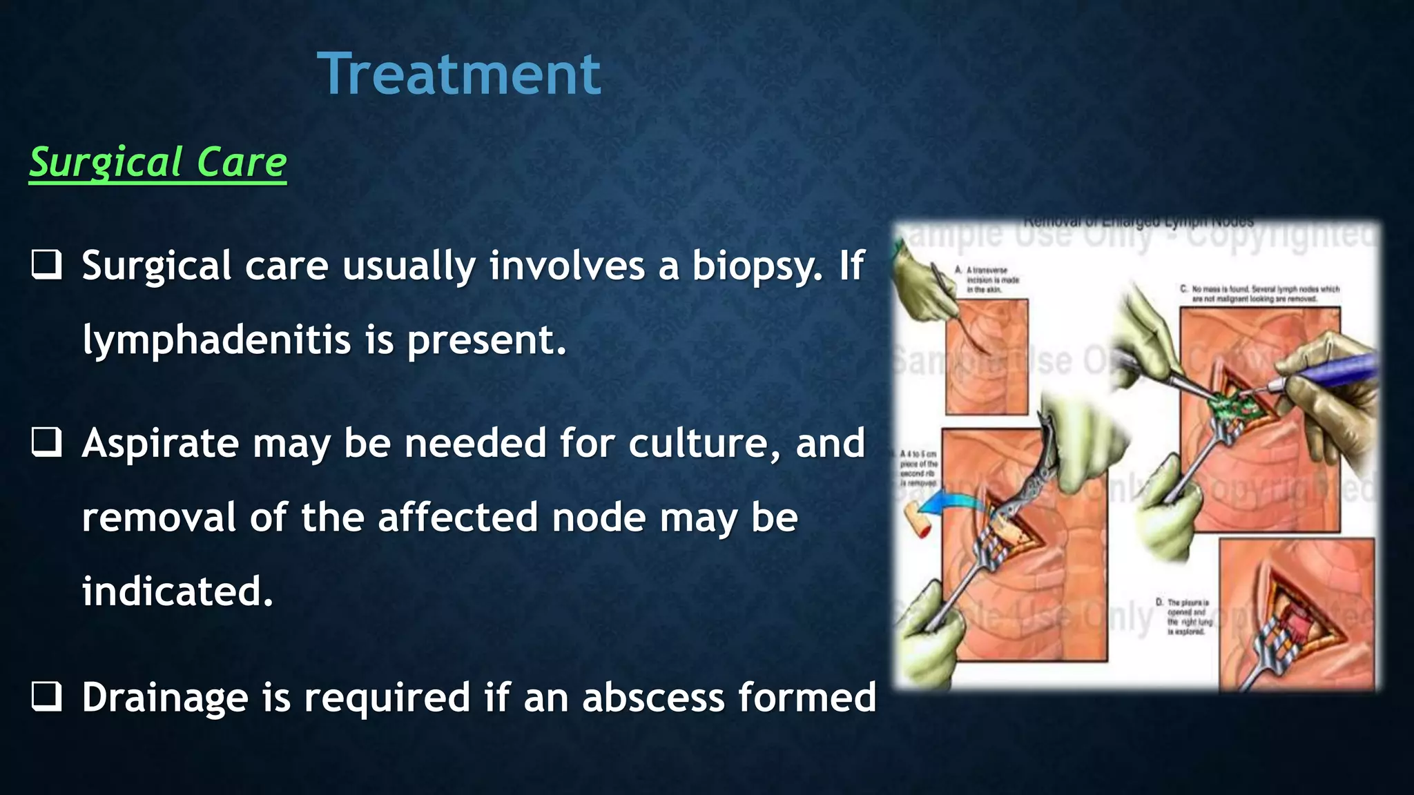 lymphadenopathy.pptx