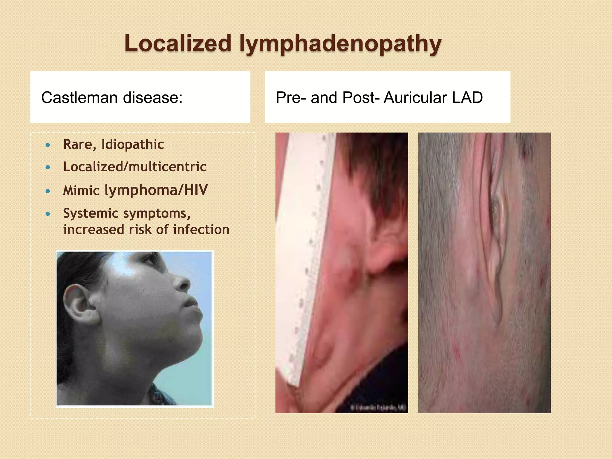 Lymphadenopathy approach | PPTX