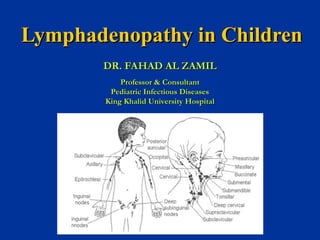 Presentation for Lymphadenopathy in Children.ppt
