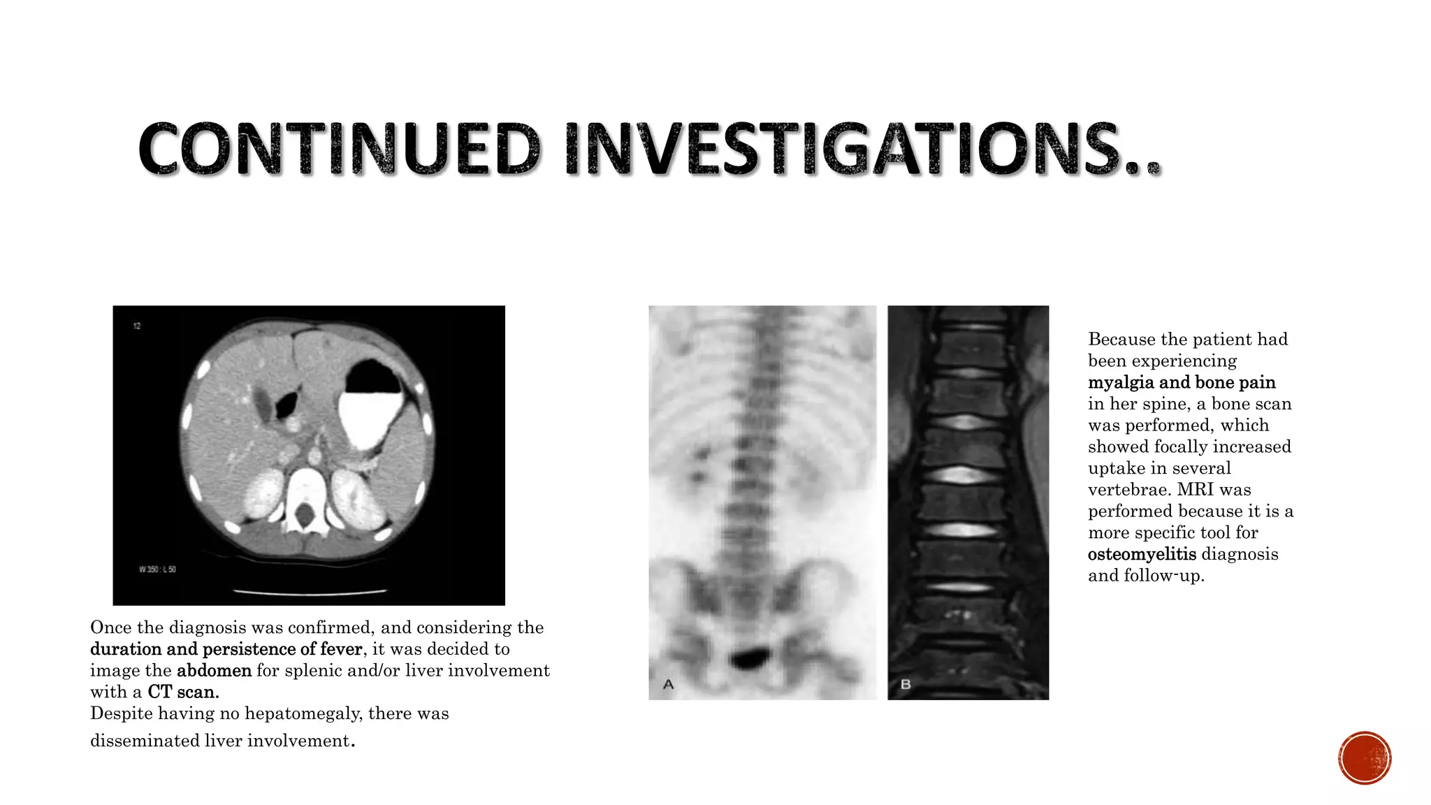 Lymphadenopathy in children | PPTX