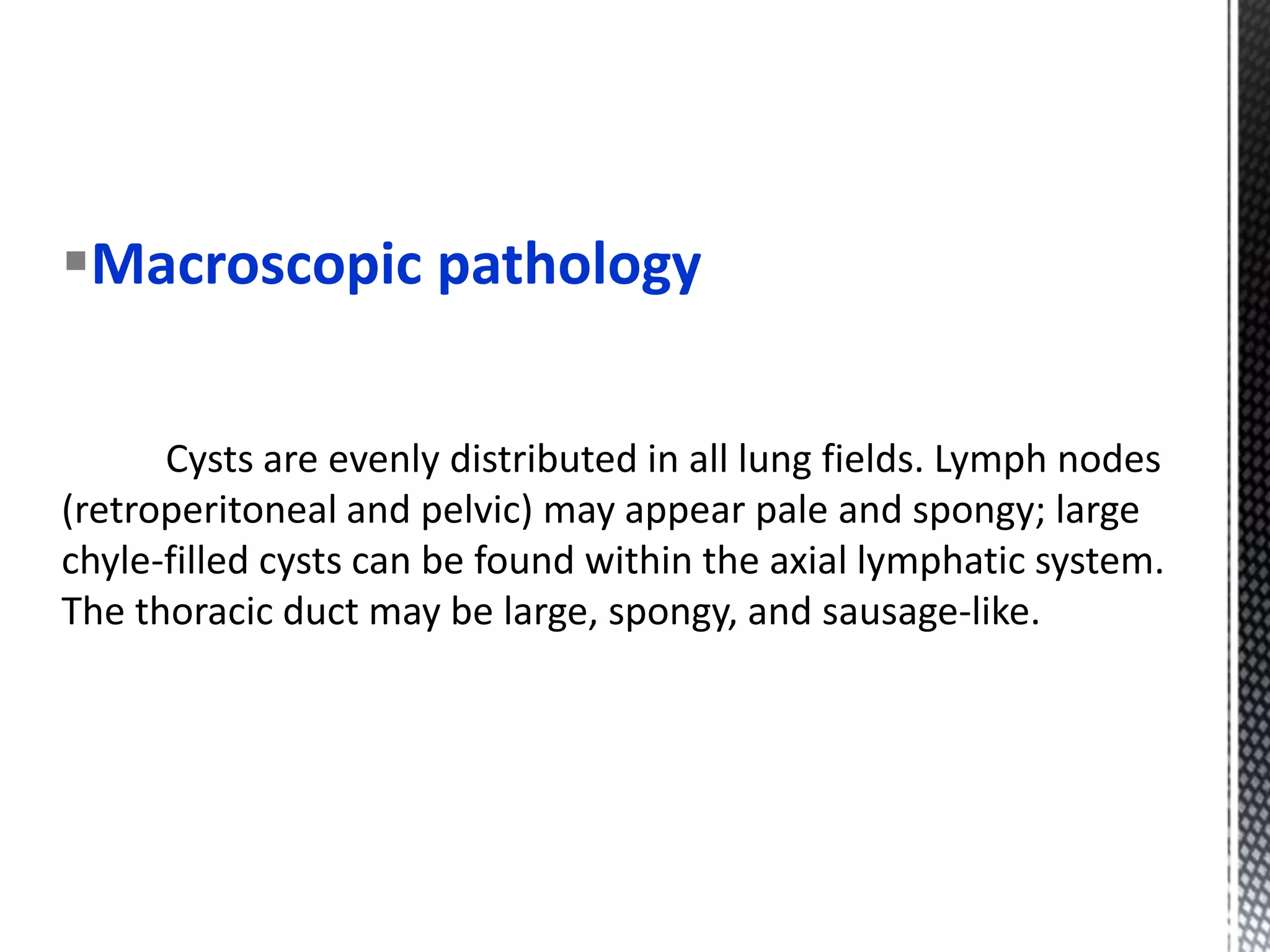 Lymphangioleiomyomatosis | PPTX