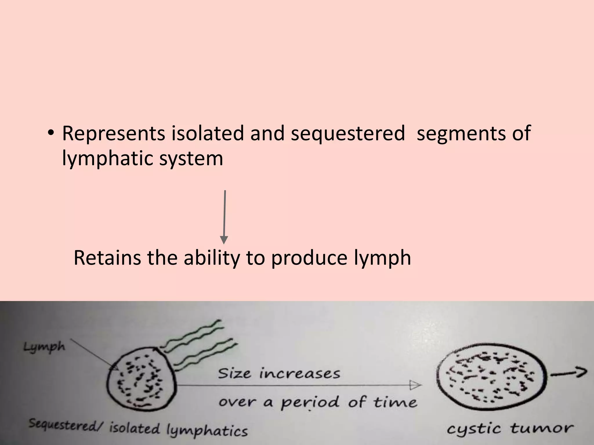 Lymphangioma | PPTX