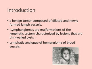 Lymphangioma | PPTX