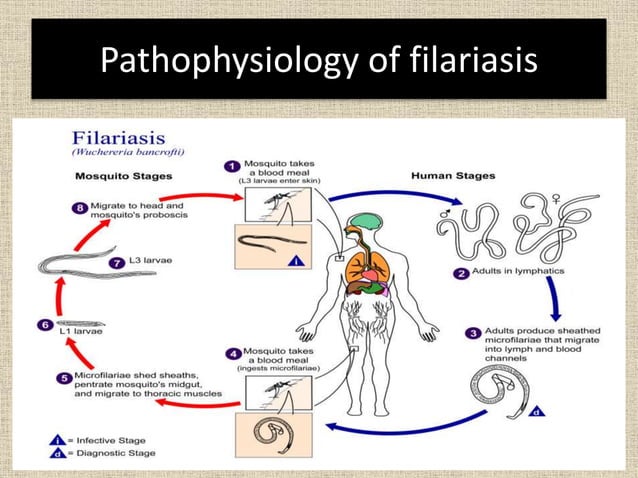 Lymphangitis-1.pptx physiotherapy ppt general surgery | PPT