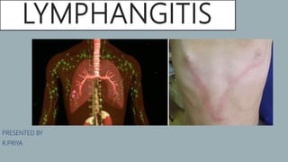 Lymphangitis | PPT