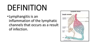 LYMPHANGITIS and lymphoedema.pptx | Infectious Diseases | Diseases and ...