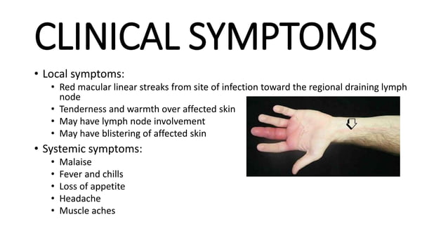 LYMPHANGITIS and lymphoedema.pptx | Infectious Diseases | Diseases and ...