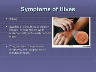 Lymphatic System | PPT