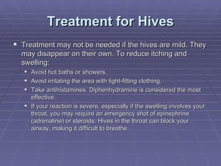 Lymphatic System | PPT