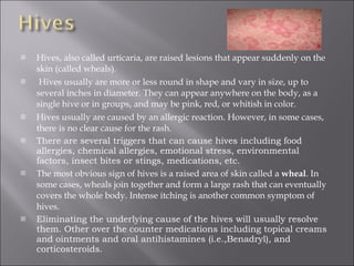 Lymphatic and immune systems presentation for chapter 6 | PPT