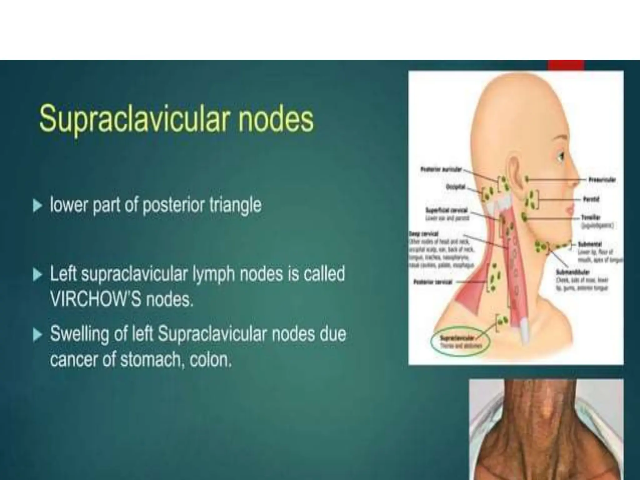 LYMPHATIC DRAINAGE OF HEAD AND NECK | PPT
