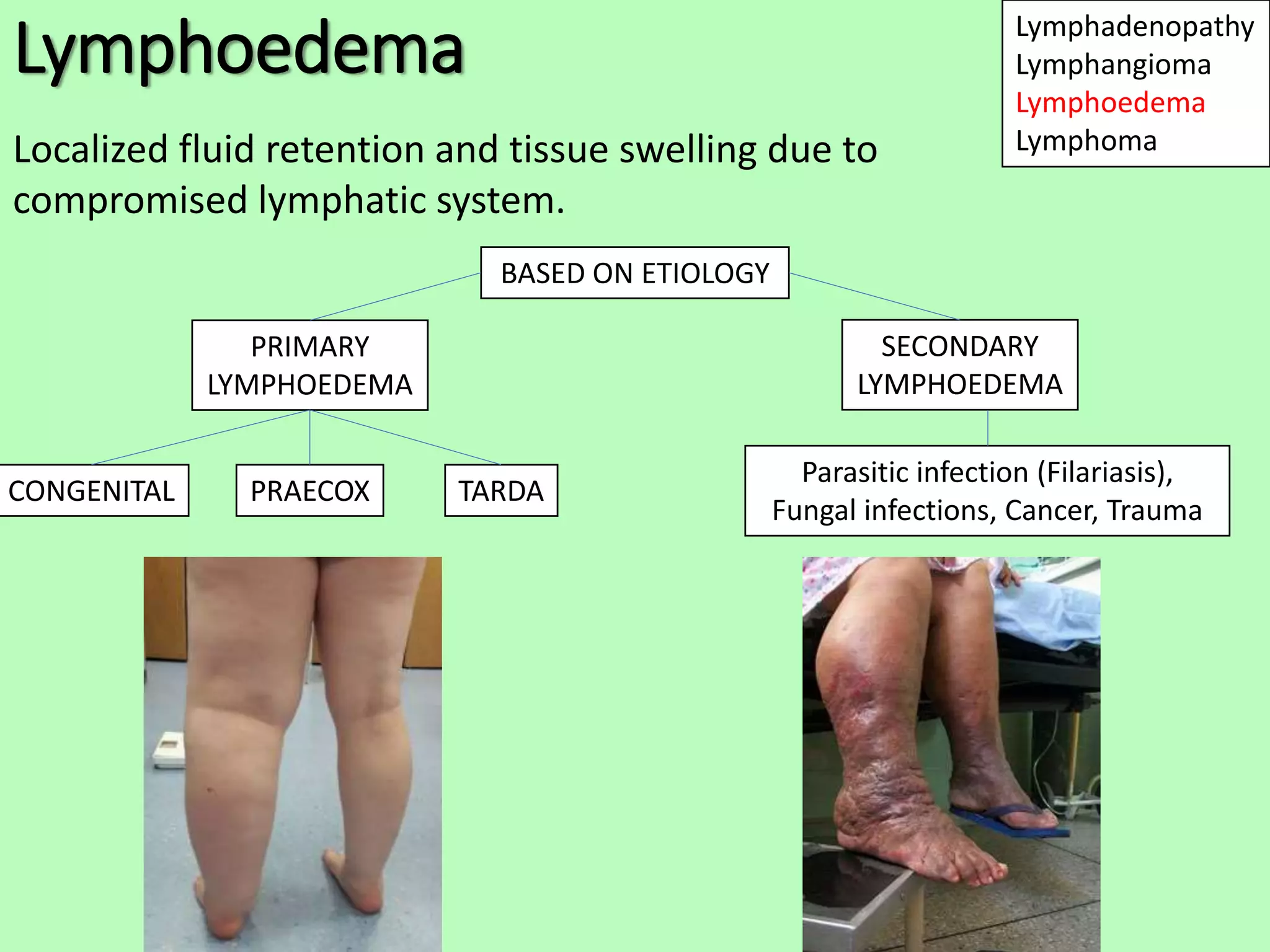 Lymphatic drainage of head and neck | PPTX
