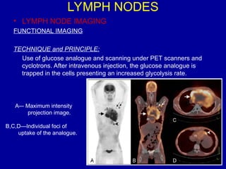 LYMPHATIC DRAINAGE OF HEAD AND NECK.,lymph fluid | PPT