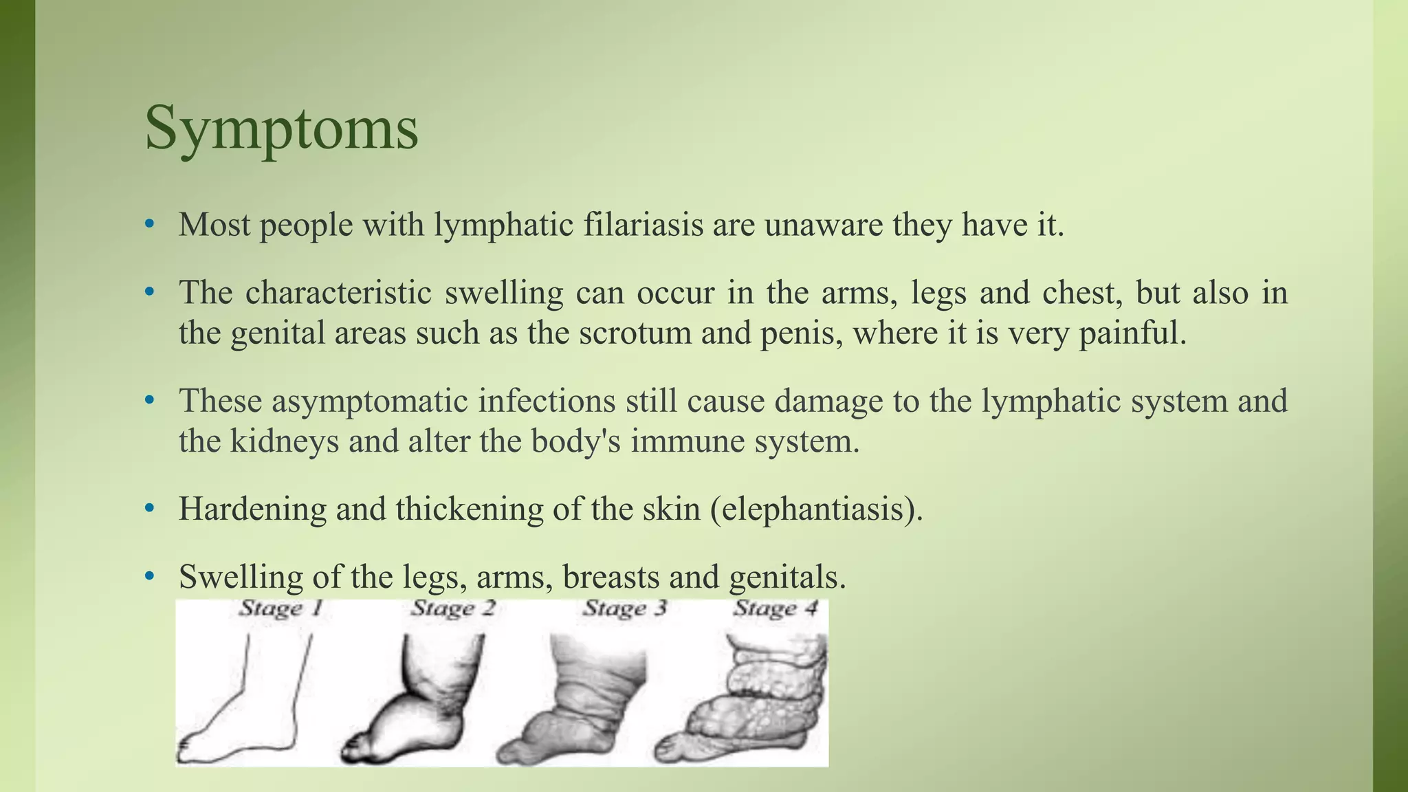 Lymphatic filariasis.pptx