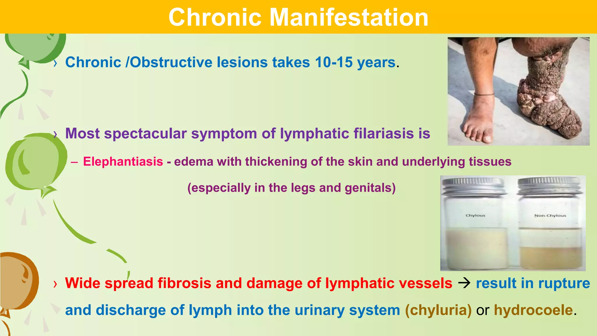 Lymphatic Filariasis | PPTX