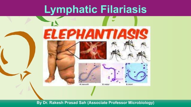 Lymphatic Filariasis | PPT