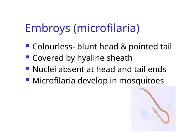Lymphatic filariasis clinical disease , labdiagnosis and treatment | PPT