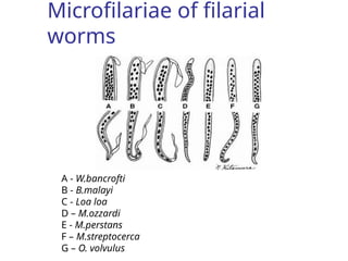 Lymphatic filariasis clinical disease , labdiagnosis and treatment | PPTX
