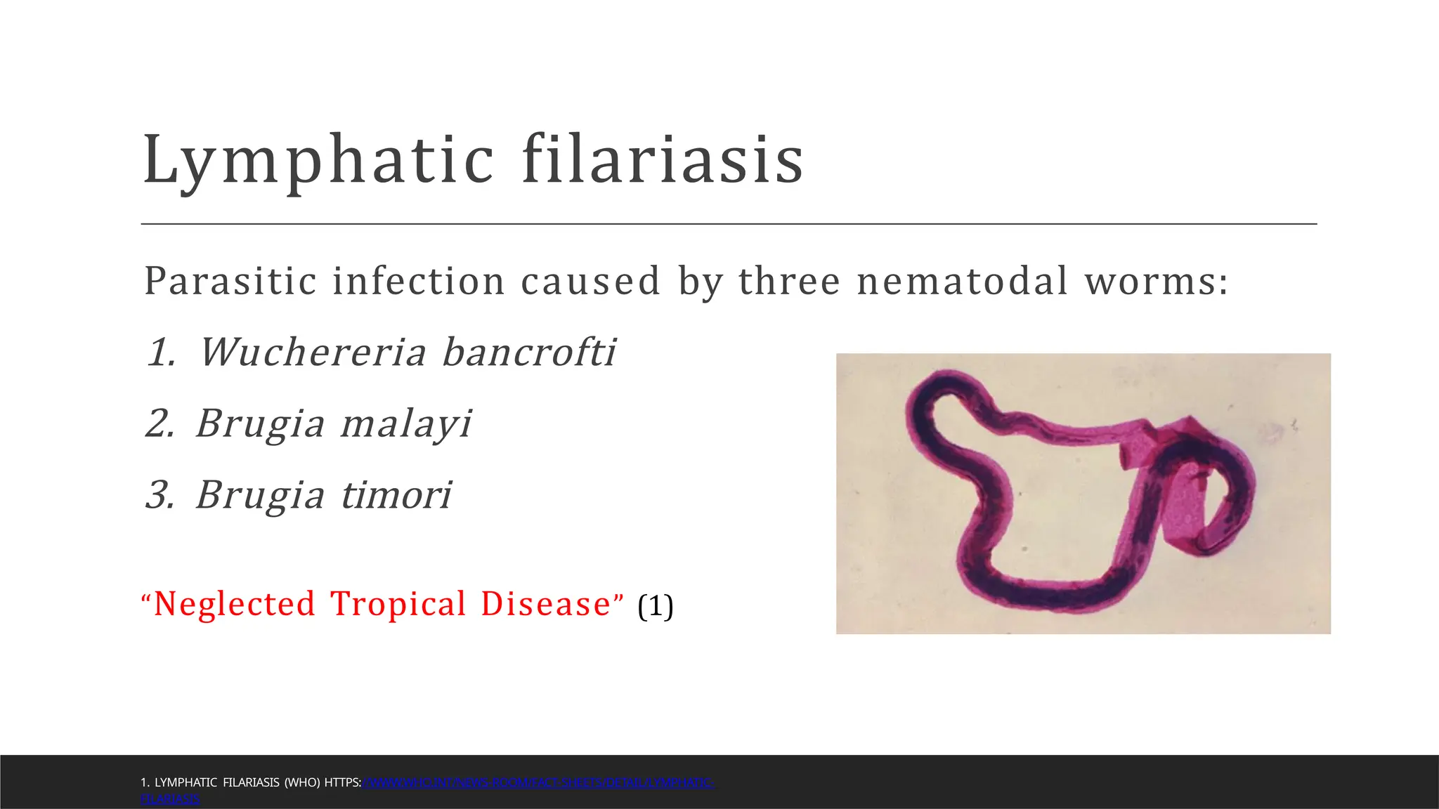 Lymphatic Filariasis - Community Medicine | PPTX
