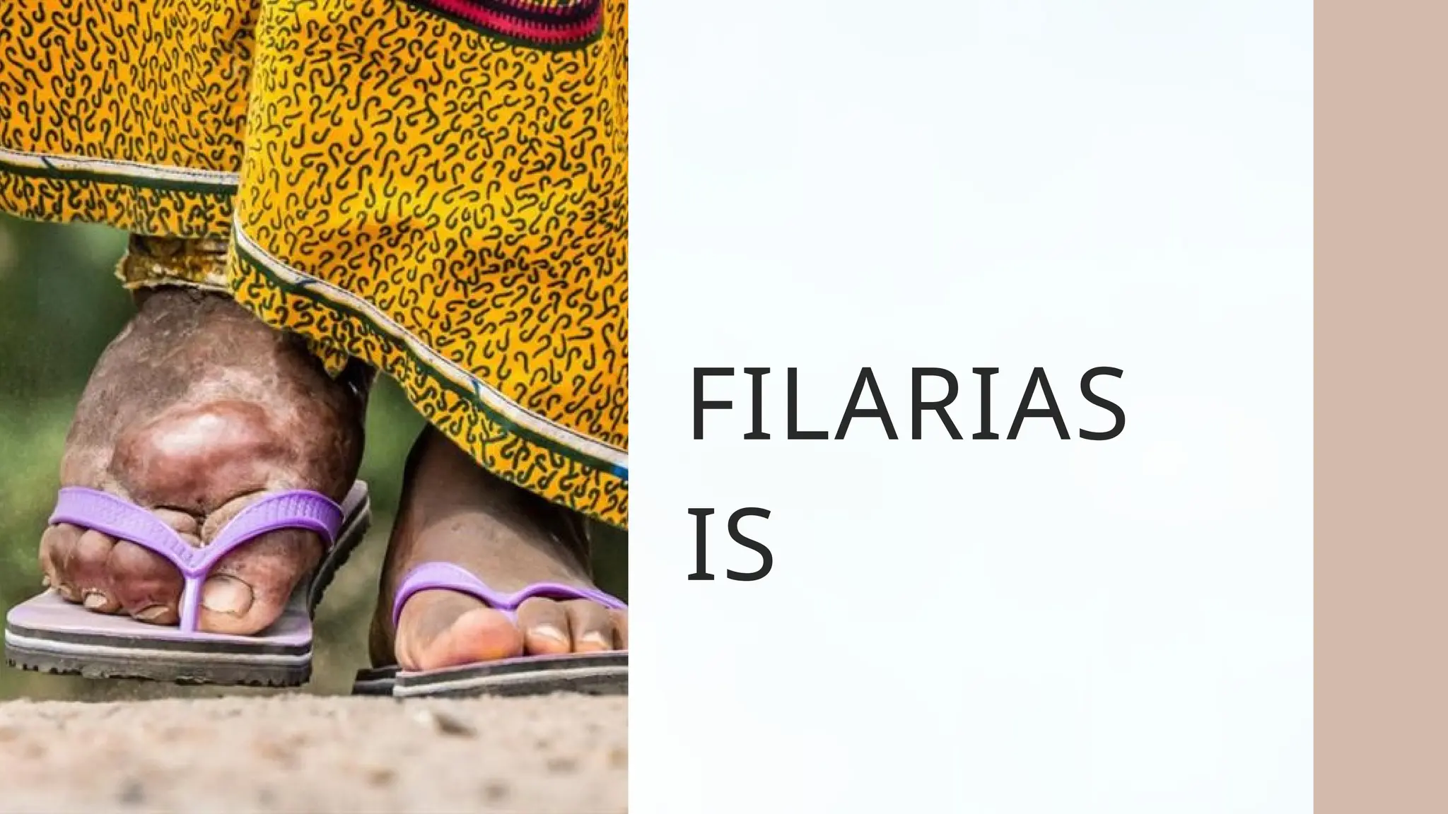 Lymphatic Filariasis: Global and National Perspective.pptx