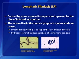 Lymphatic Filariasis Winnable Battle presentation | PPTX