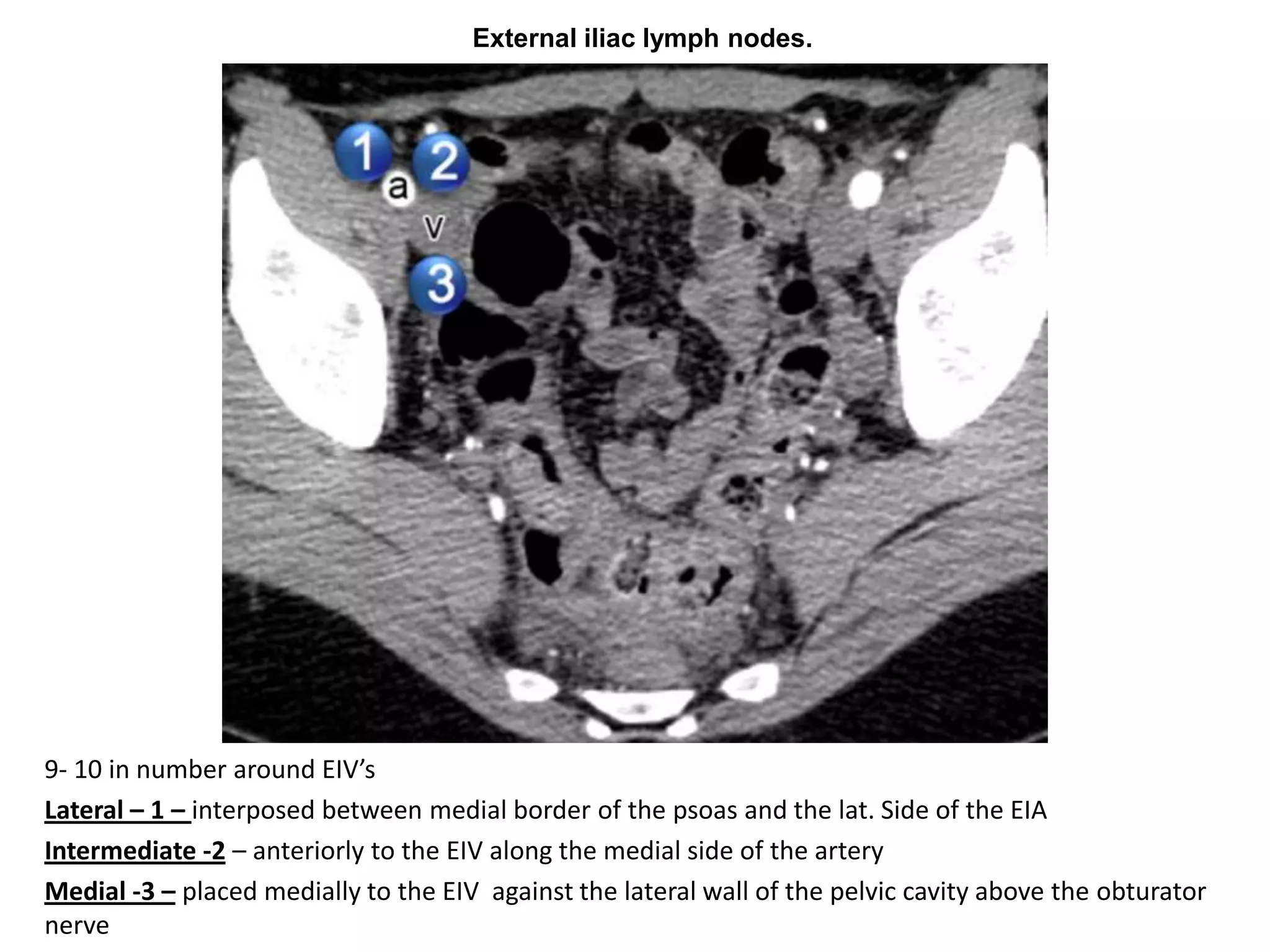 Lymphatics of the pelvis | PPTX