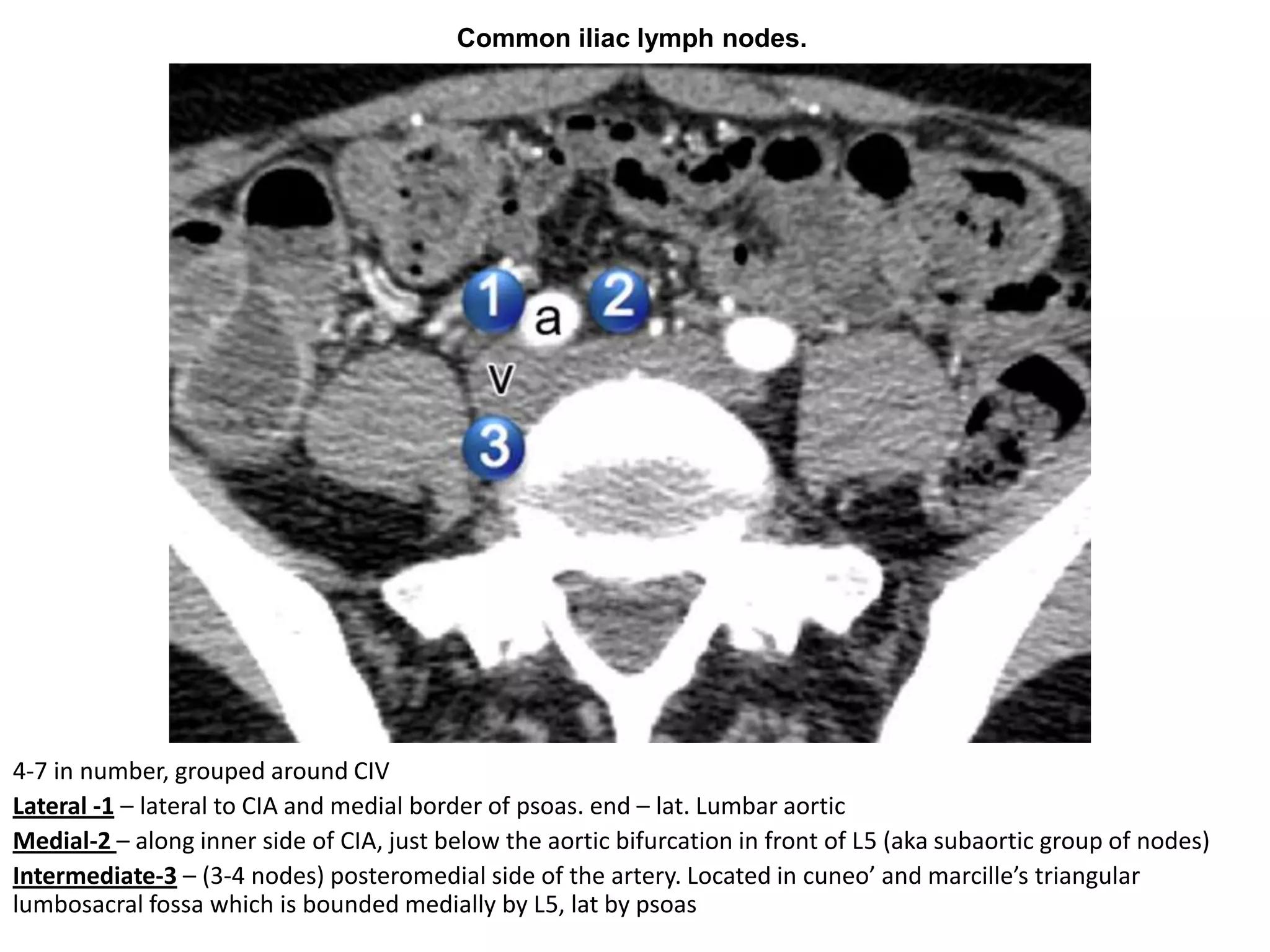 Lymphatics of the pelvis | PPTX