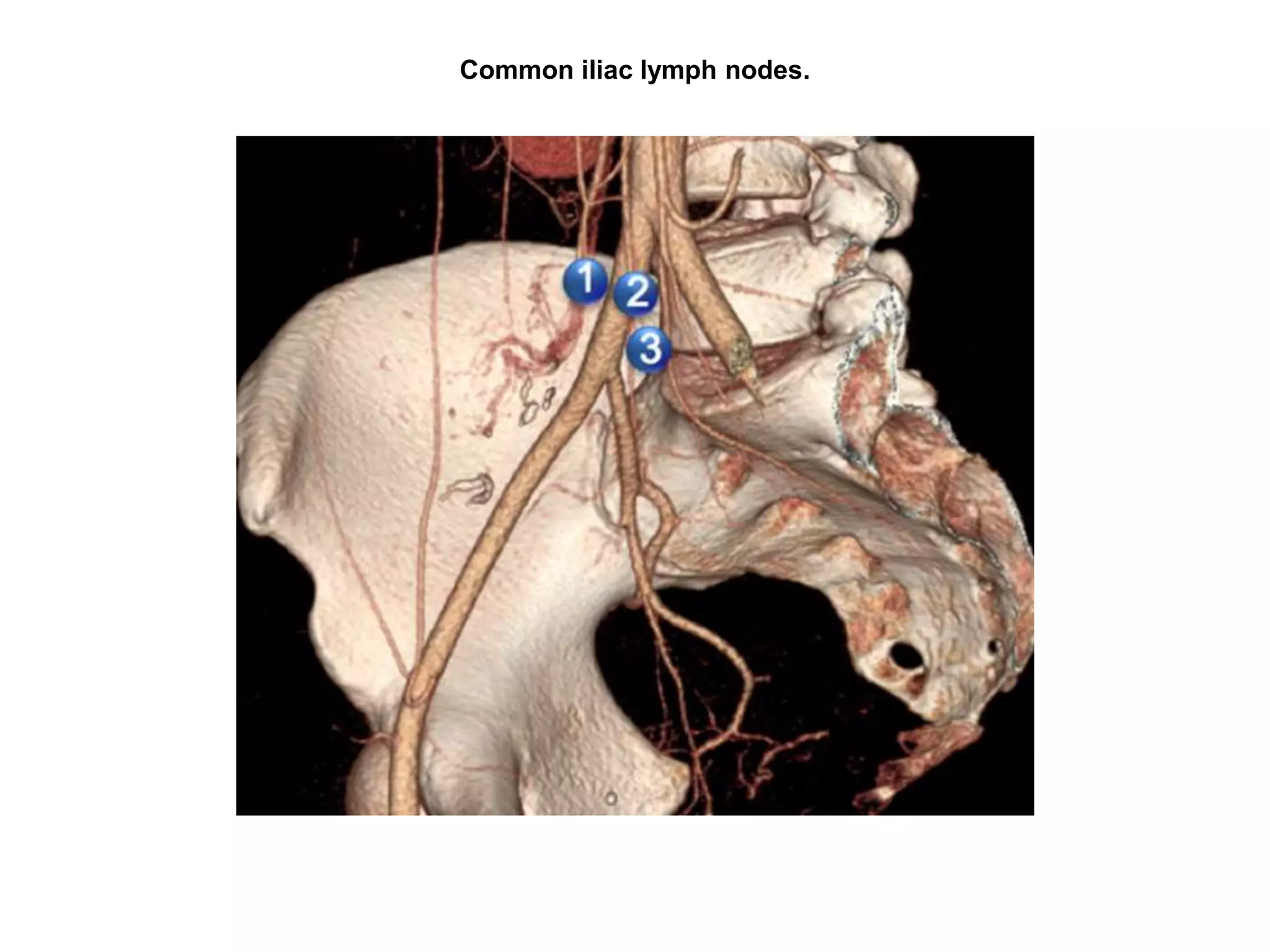 Lymphatics of the pelvis | PPTX