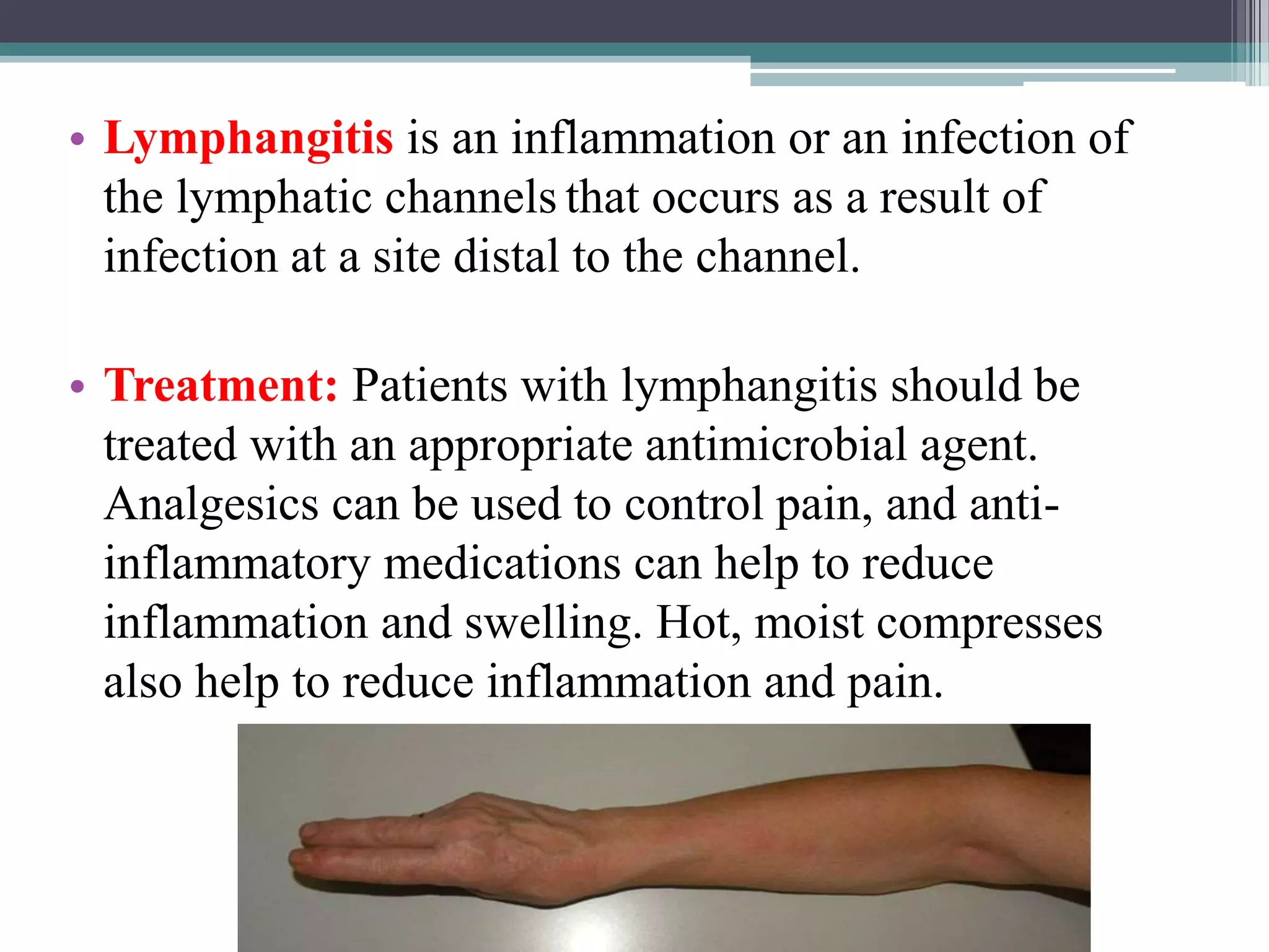 Lymphatic system | PPTX
