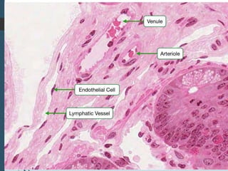 Lymphatic Vessels Slide
