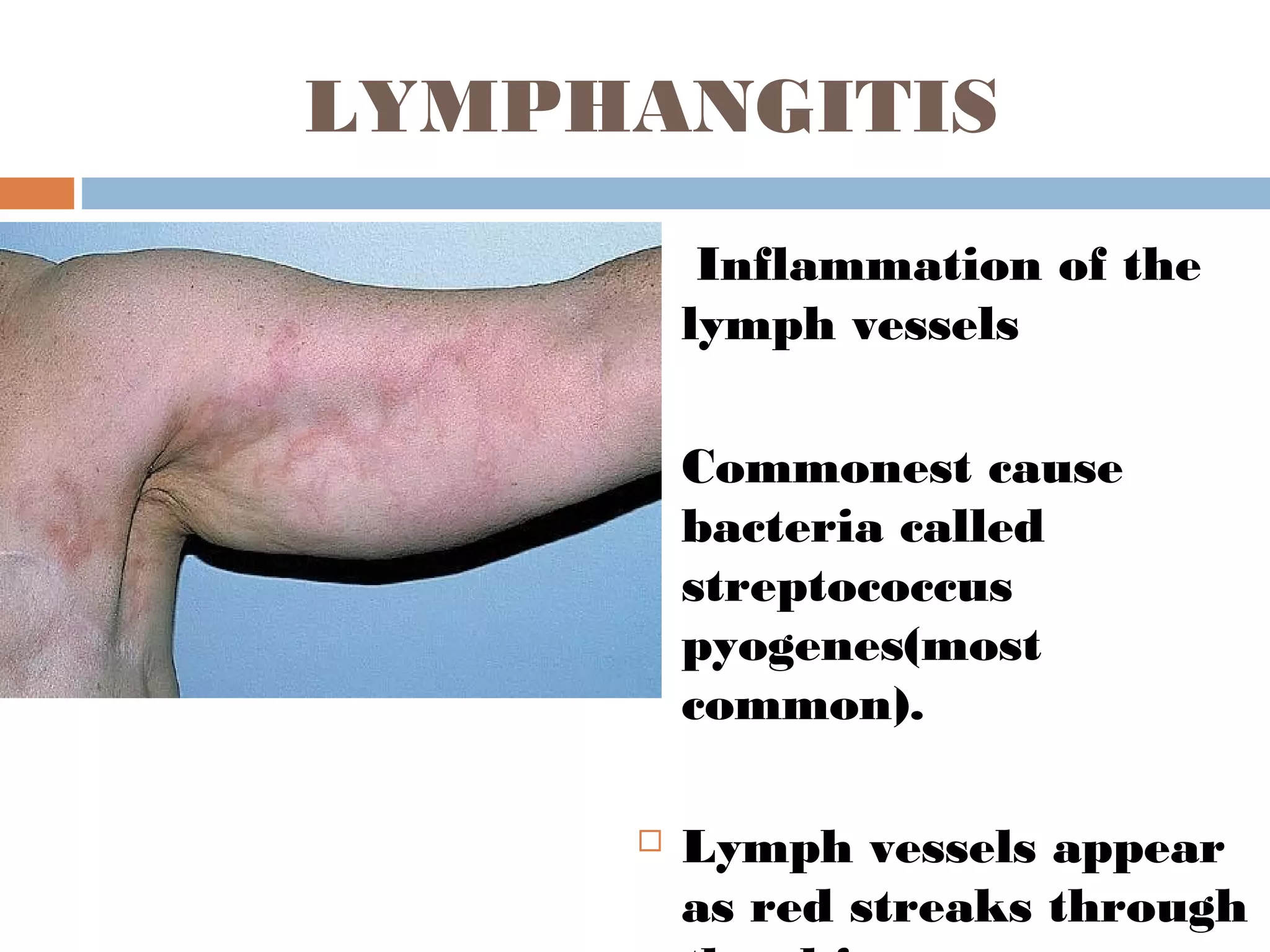 Lymphatic system (function of lymphatic systems) | PPT