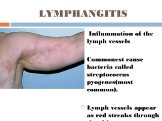 Lymphatic system (function of lymphatic systems) | PPT
