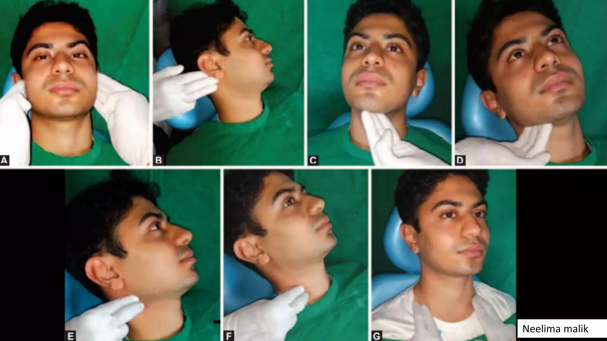 Lymphatic system of Head&Neck ; TNM Staging 8th edition | PPTX