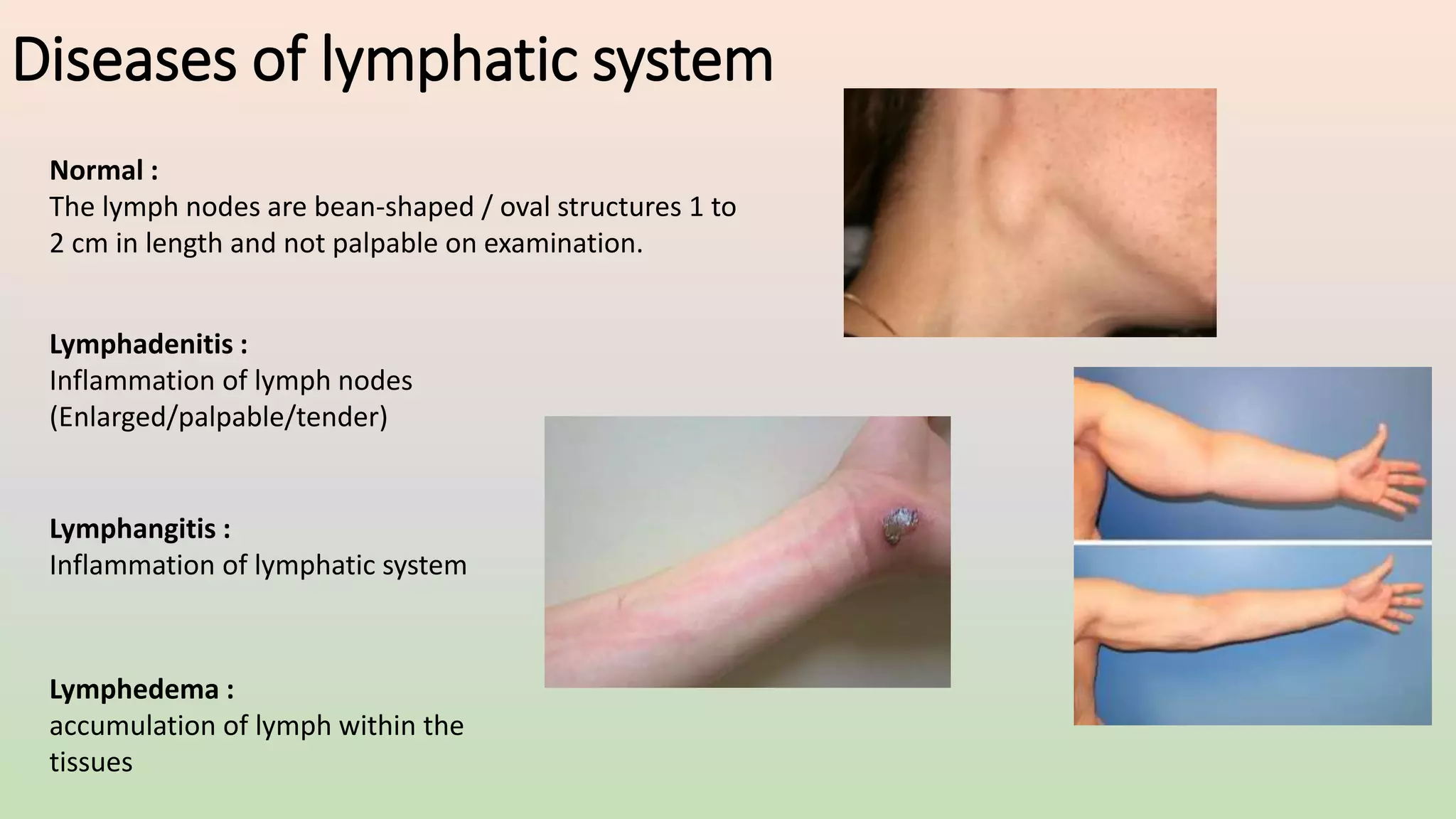 Lymphatic system of Head&Neck ; TNM Staging 8th edition | PPTX