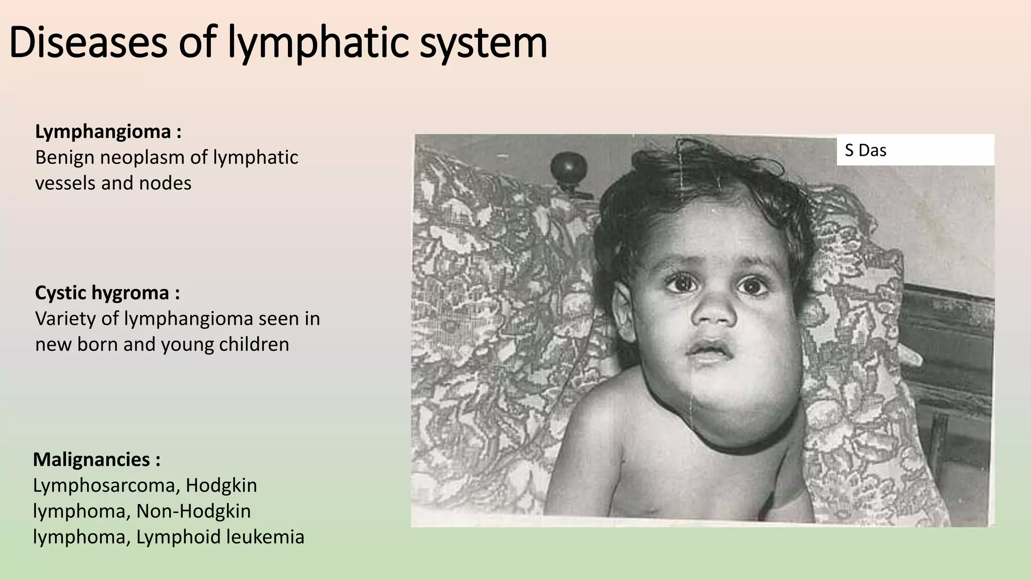 Lymphatic system of Head&Neck ; TNM Staging 8th edition | PPTX
