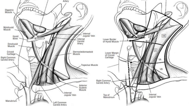 Lymphatic system of Head&Neck ; TNM Staging 8th edition | PPTX | Ear, Nose and Throat Conditions ...