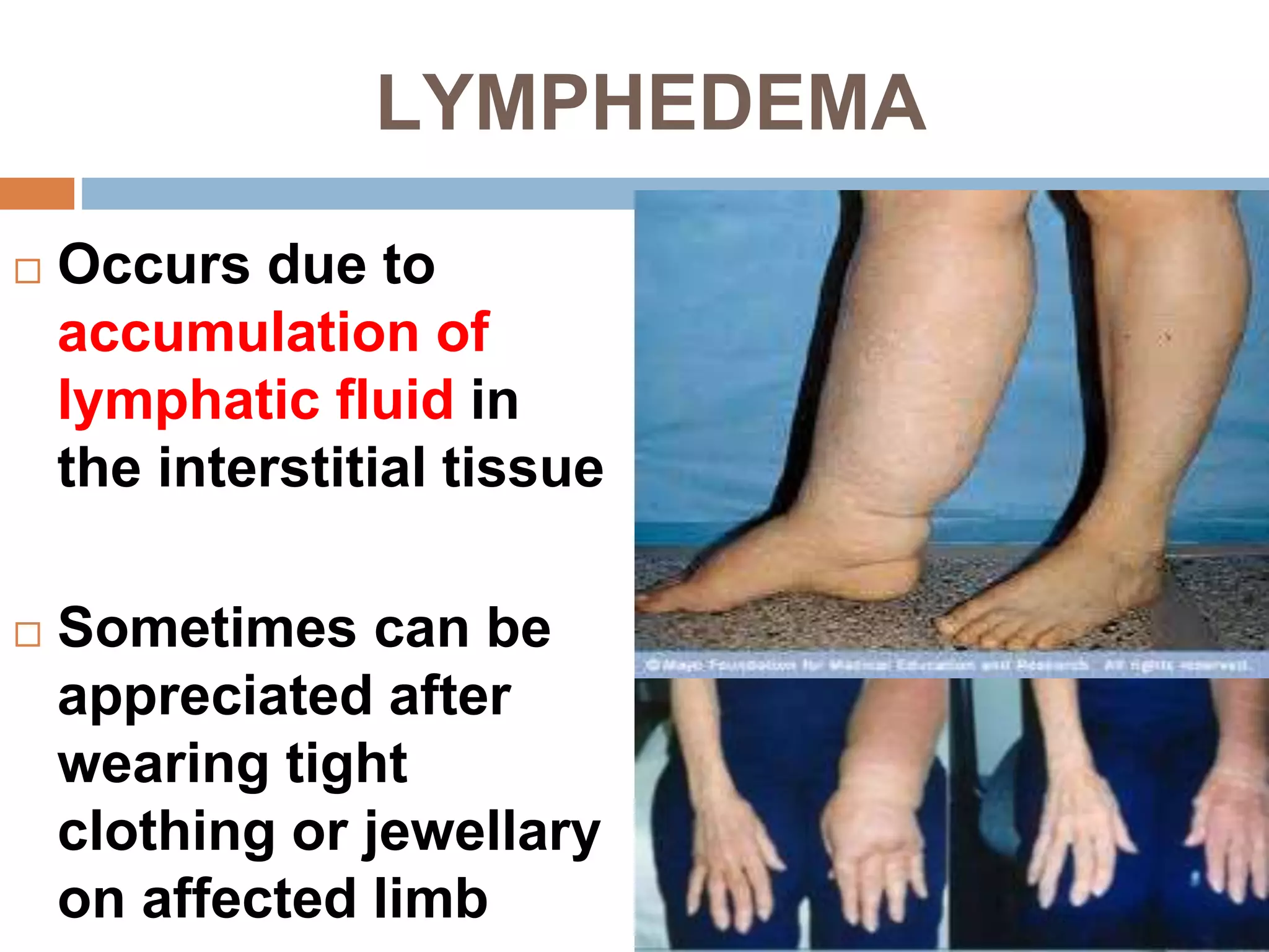 lymphatic_system.ppt