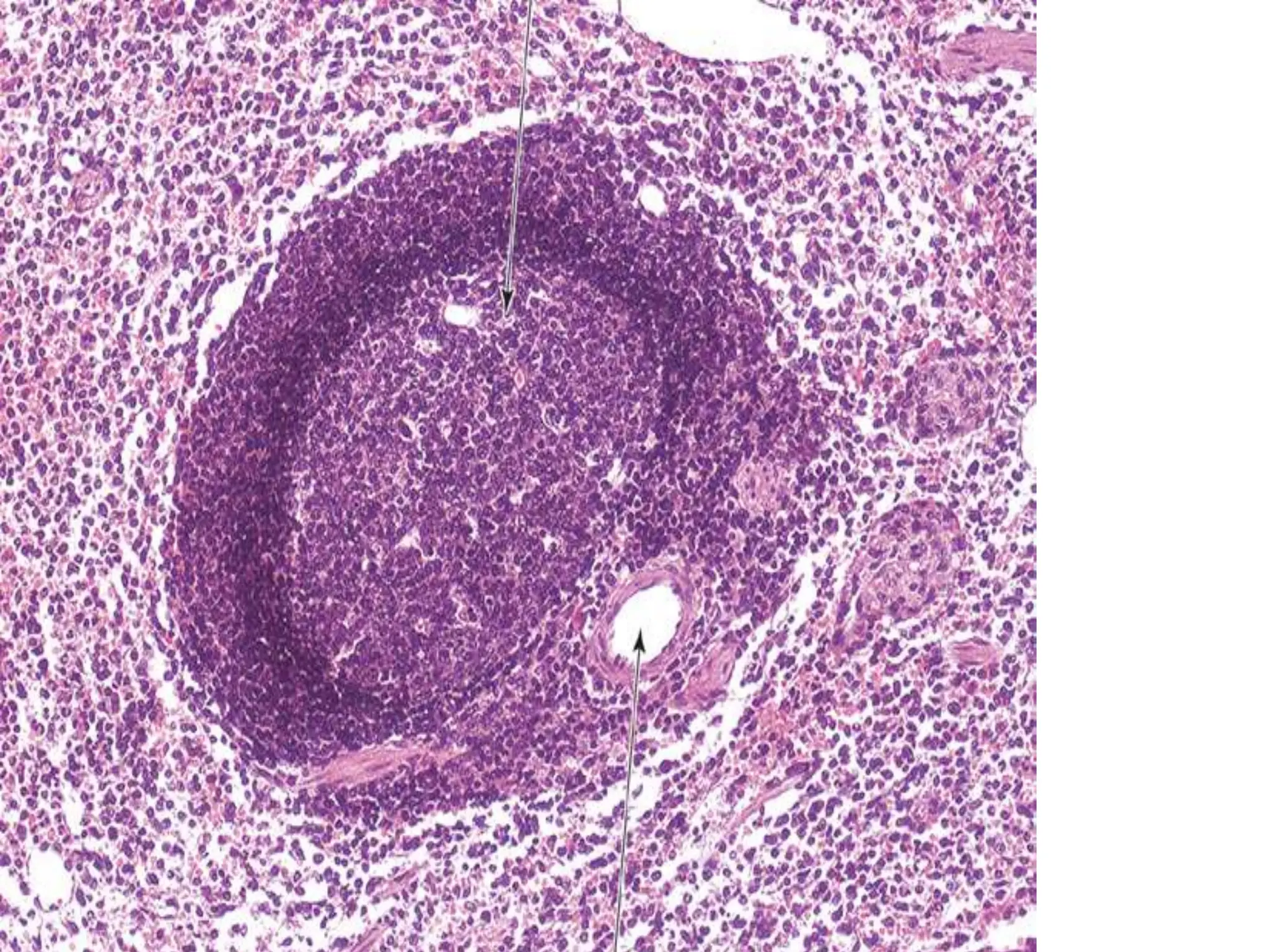 Lymphatic system easy lecture notes .ppt